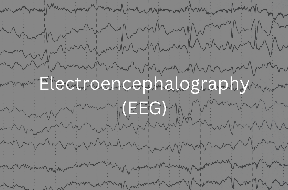 Research | The Interactive Dynamics of Episodic Memory Lab